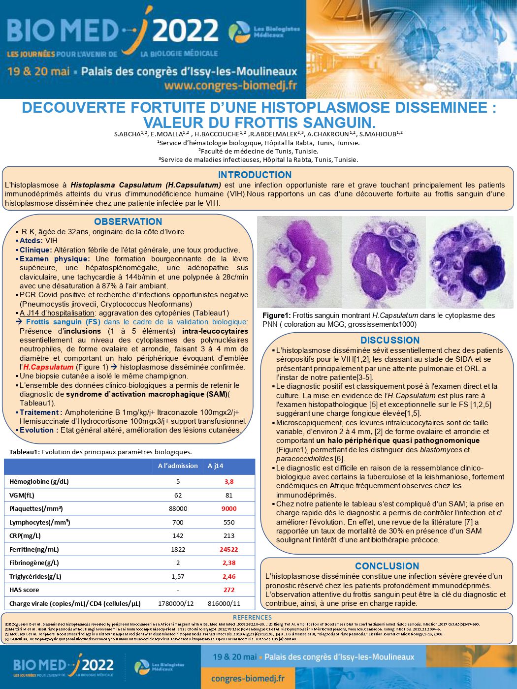 Decouverte fortuite d’une histoplasmose disseminee : valeur du frottis ...