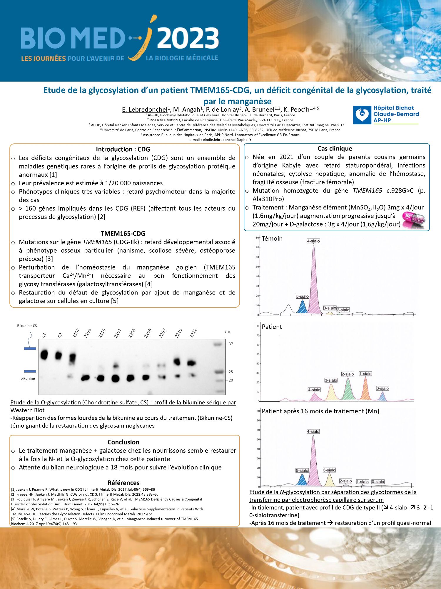 Etude de la glycosylation d’un patient TMEM165-CDG, un déficit ...