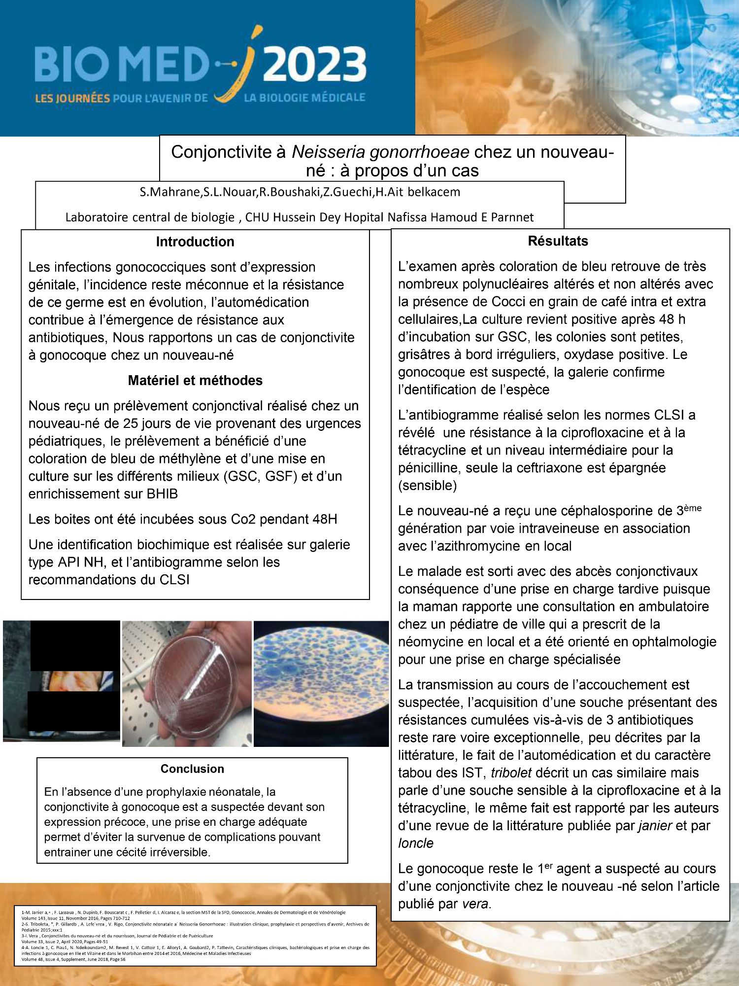 Conjonctivite à Neisseria gonorrhoeae chez un nouveau-né : à propos d ...